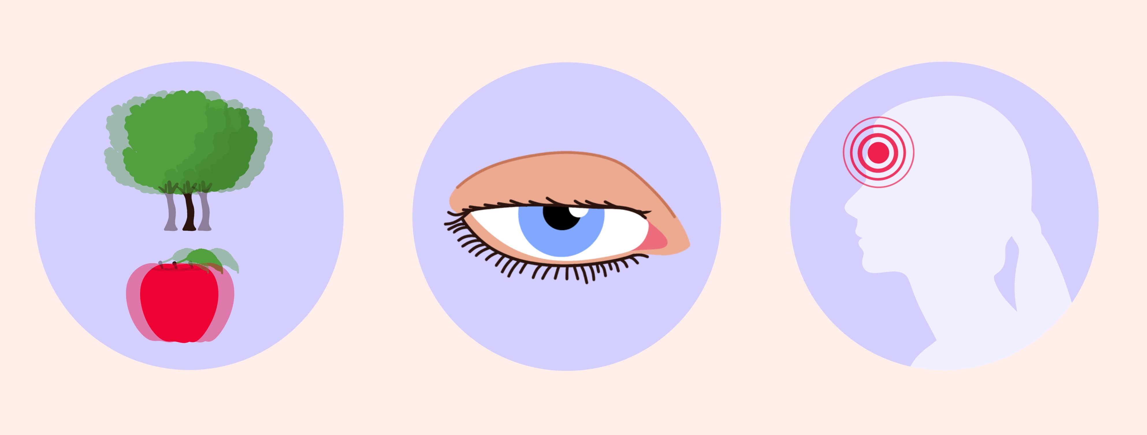 Astigmatismo: sintomi e cause | Redcare